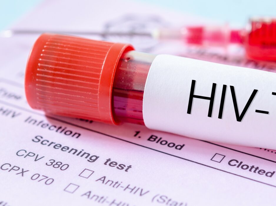 UN Says Decline In External Financing Expanding HIV Cases In Africa, Others